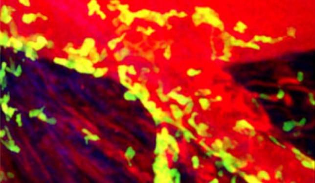 Descubren una molécula que convierte células madre en células cardíacas