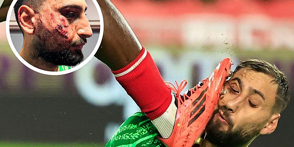 Terroríficas imágenes de la patada que le desfiguró la cara a Donnarumma