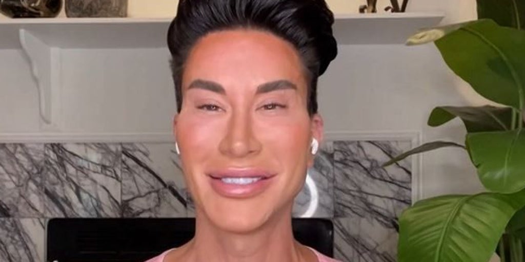 Justin, el 'Ken humano' que lleva mil operaciones estéticas: «Al ...