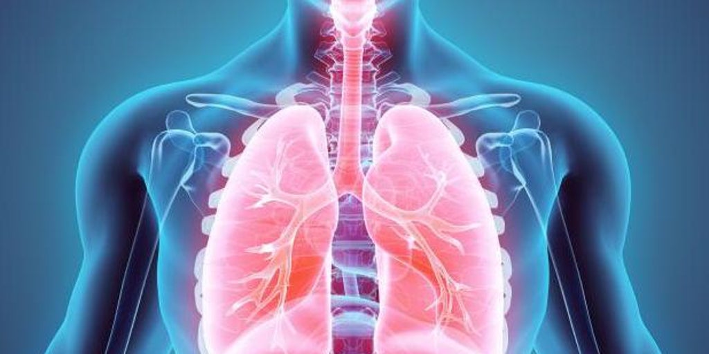 Edema pulmonar: qué es y cómo identificar sus síntomas