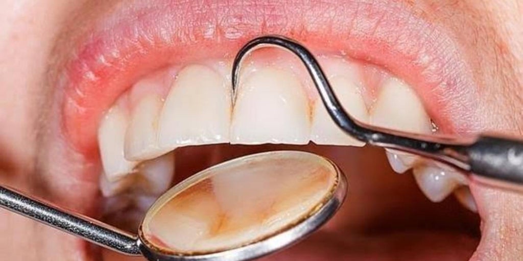 Síntomas que avisan de que puedes tener un cáncer de lengua