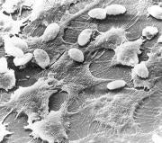 Hallan que el virus JC está implicado en la aparición de tumores ...