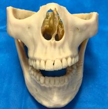 «La impresión 3D es, en medicina, lo que el simulador de Fernando ...